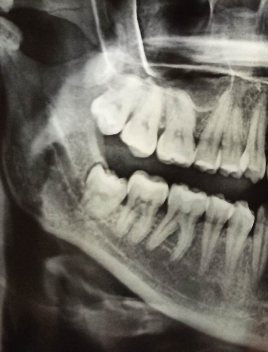 Вадене на мъдрец... | Стоматология | Страница 244 | Мнения от BG-Mamma